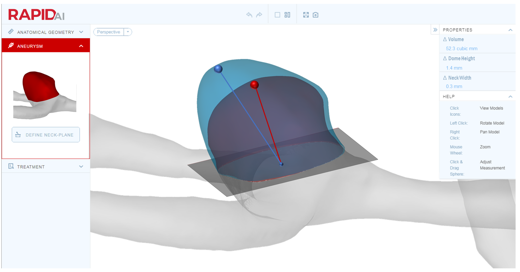 Neuroimaging Stroke Software Platform Powered by AI | RapidAI
