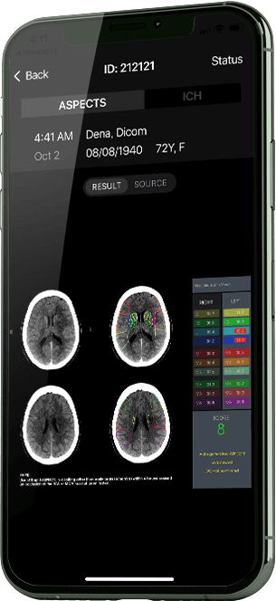 Neuroimaging Stroke Software Platform Powered by AI | RapidAI